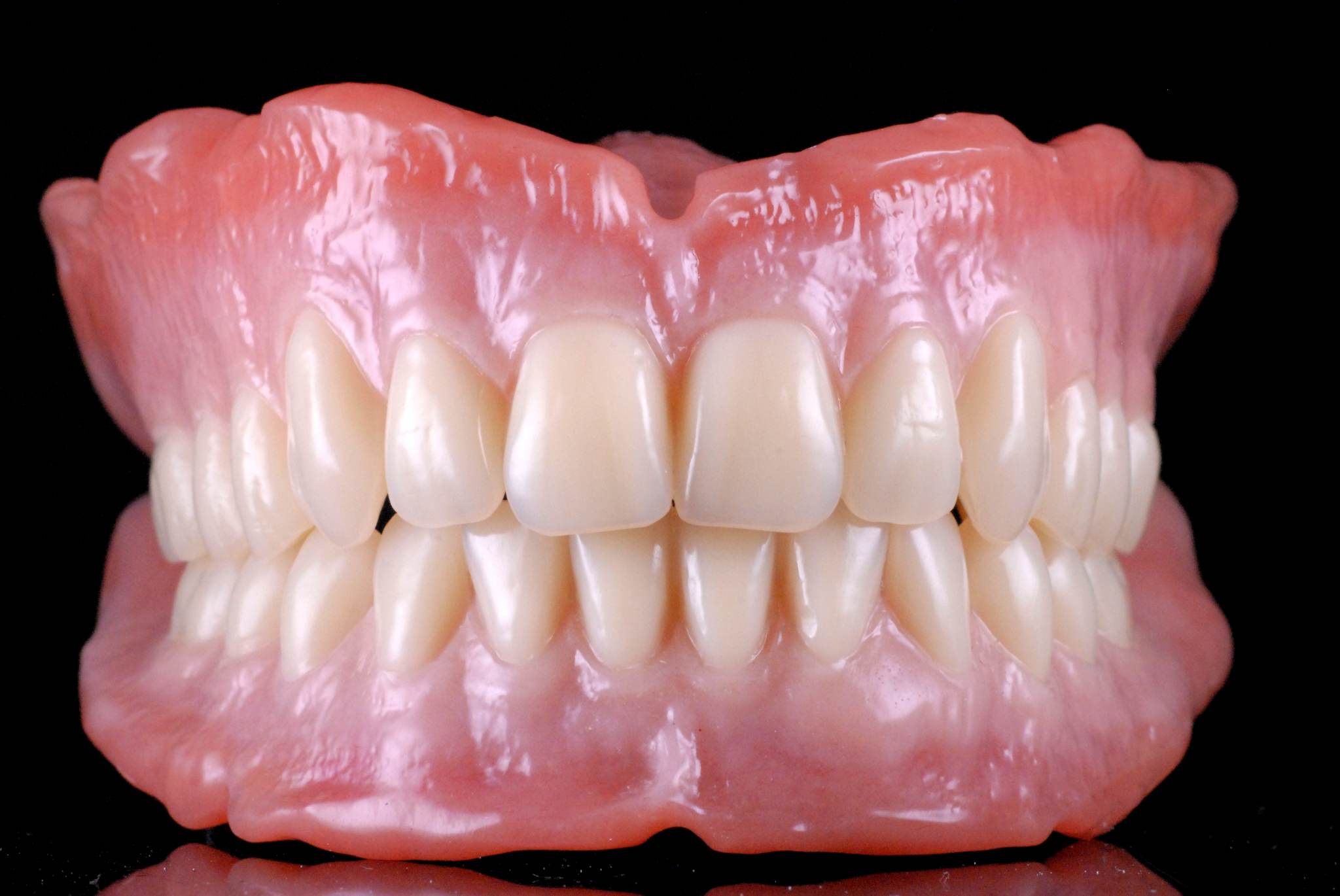 BPS fogsor, a kivehető fogpótlások csúcsa | Smile Design Center